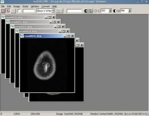 How to make Animated GIFs (of your Brain Scan) - SheekGeek